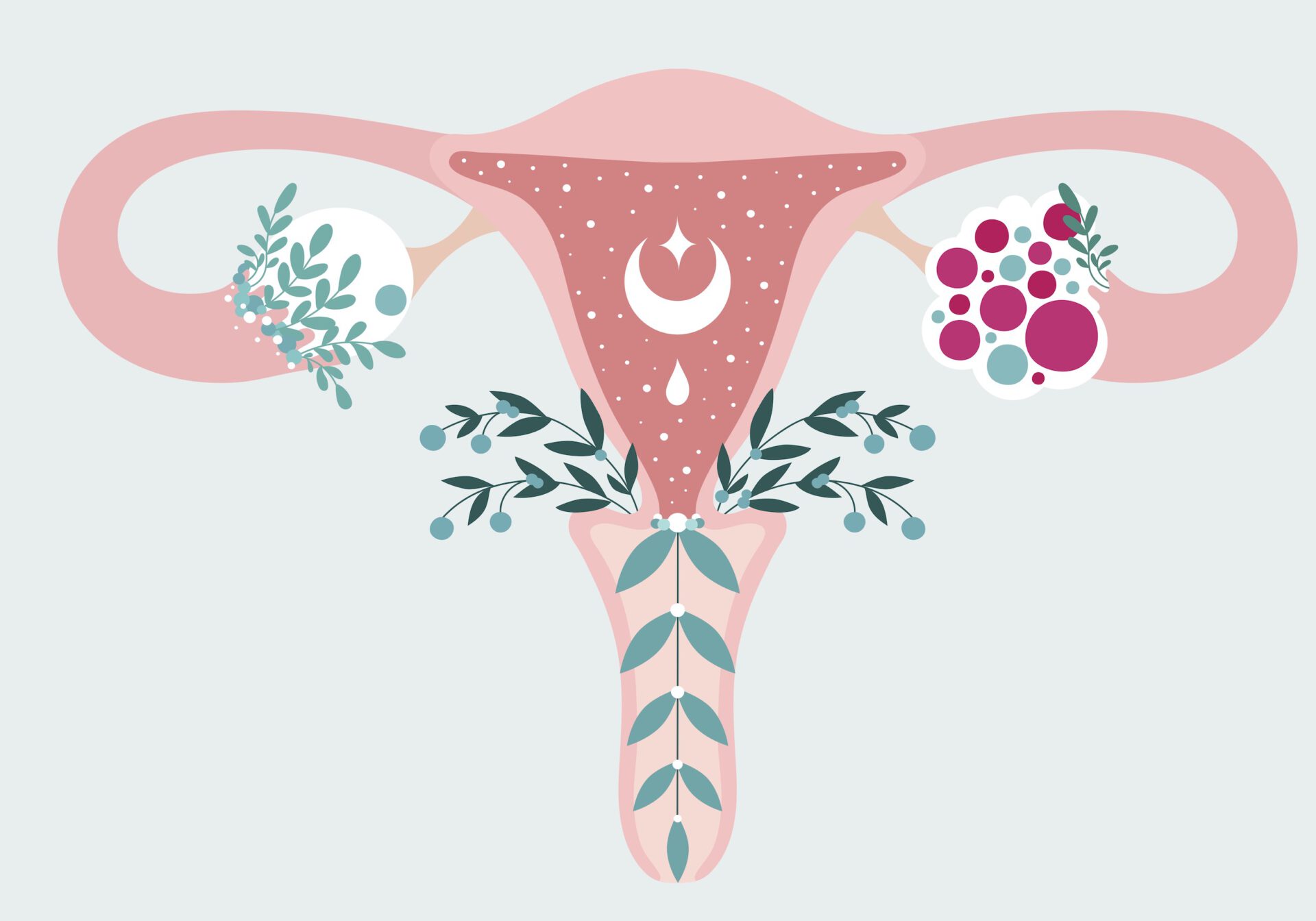 Polycysteus-Ovariumsyndroom (PCOS) | Metabolic Balance